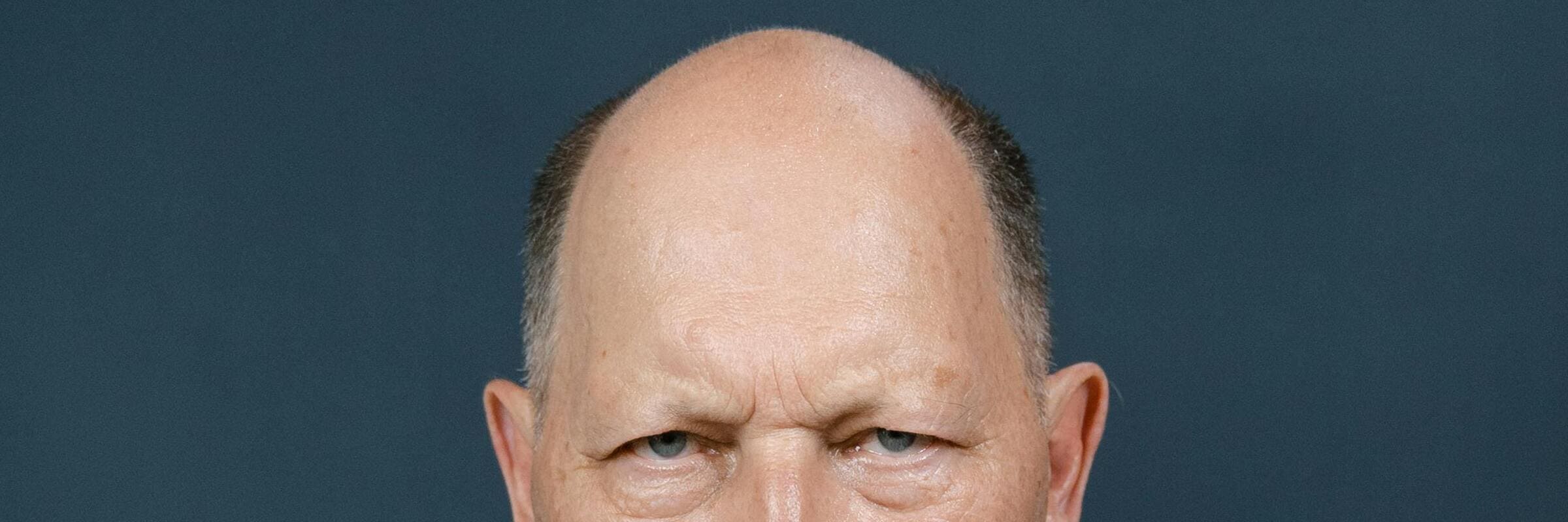 De quién se hereda la calvicie, ¿del padre o de la madre?